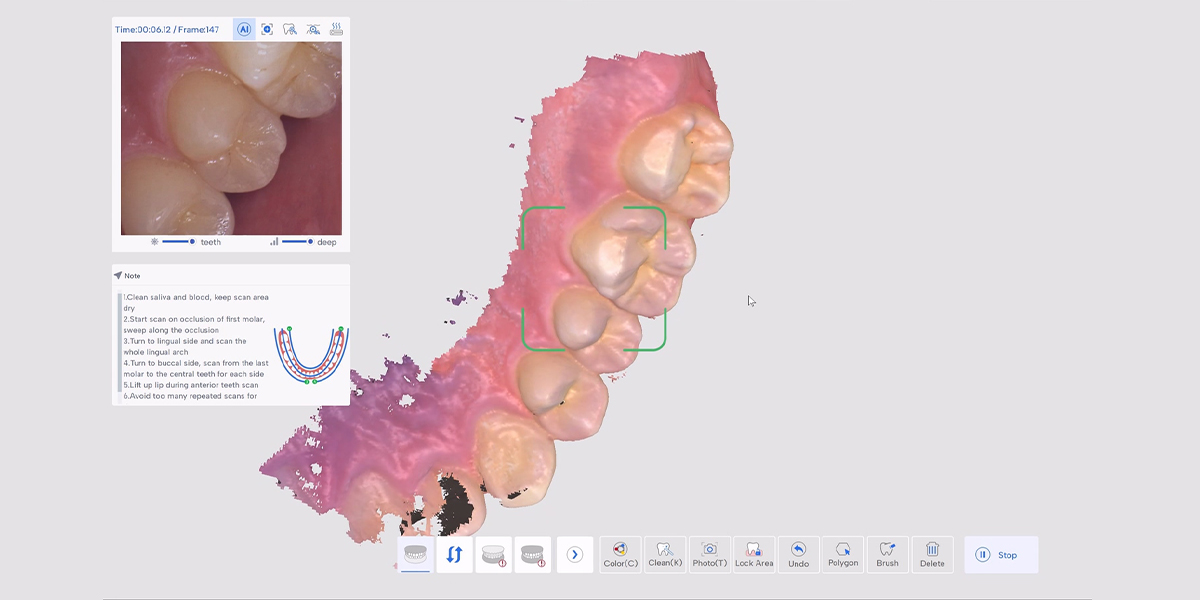 Dental Oral Scanner Manufacturer | DEPRAG